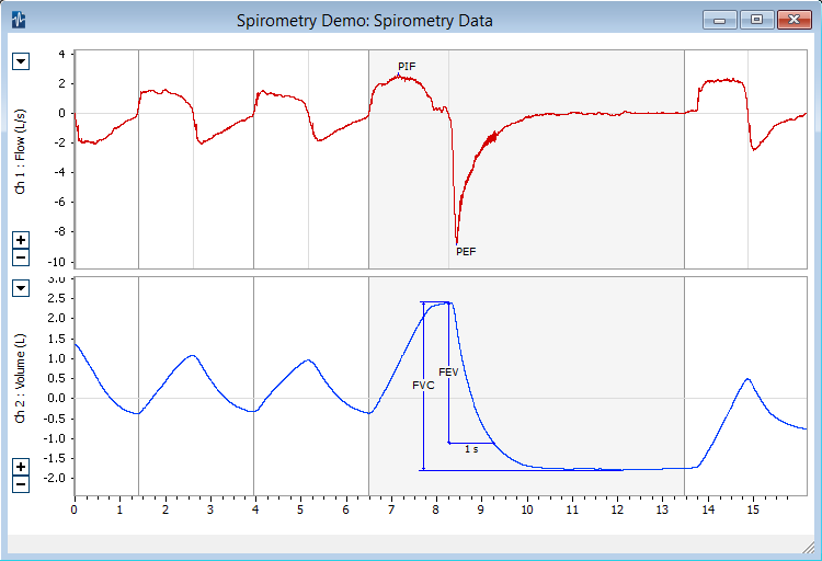 Spirometry | ADInstruments