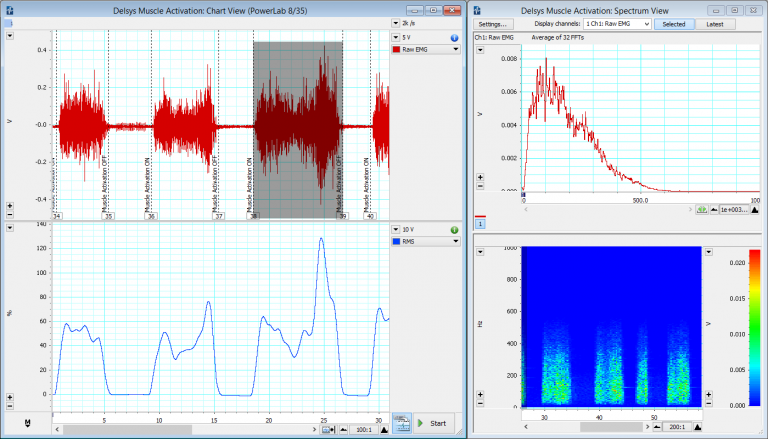 EMG | ADInstruments