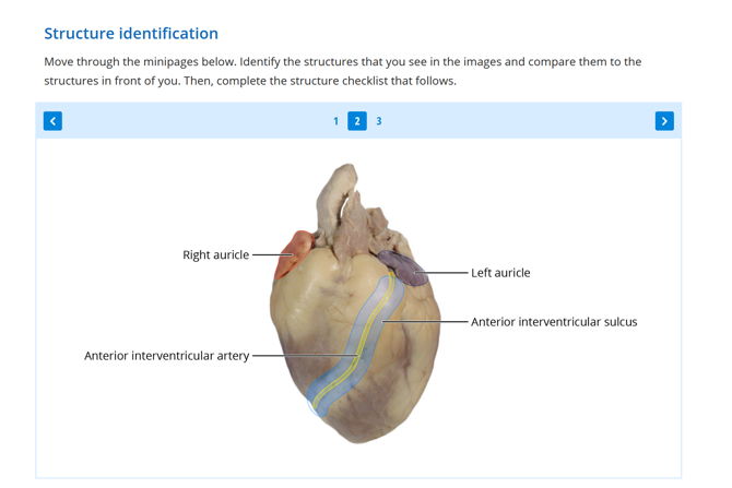 Heart Dissection | Lt Anatomy Collection | ADI