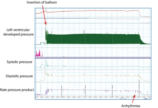 Langendorff isolated heart experimental considerations | Retrograde ...