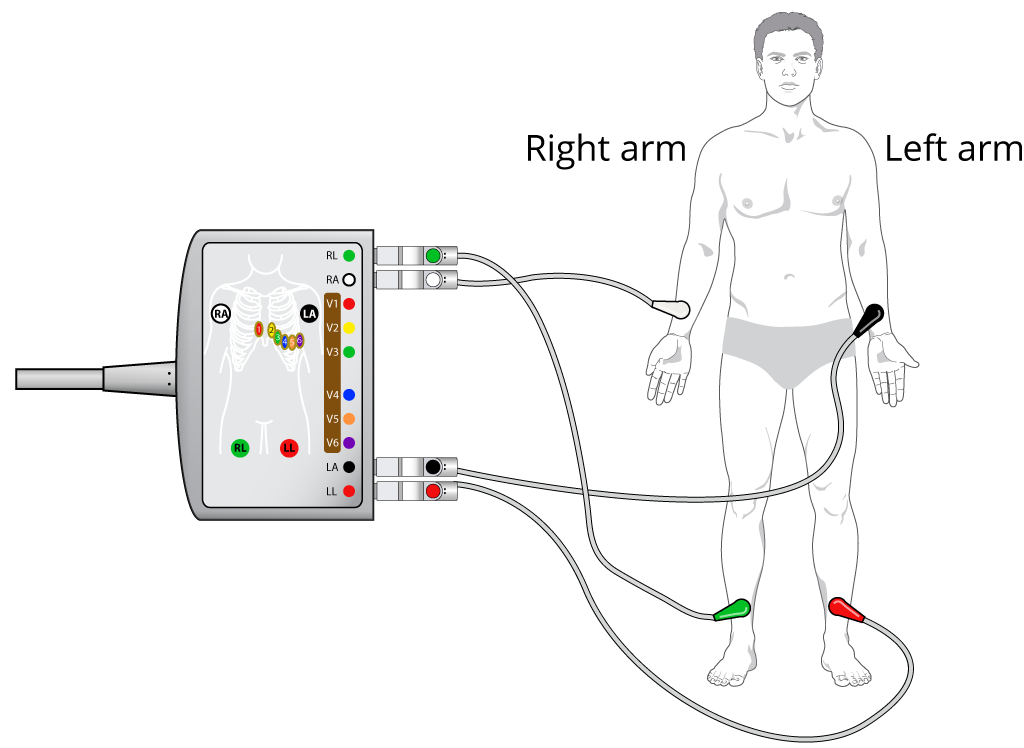 Settings for Sampling Panels in Lt - ECG and Heart Rate | ADInstruments