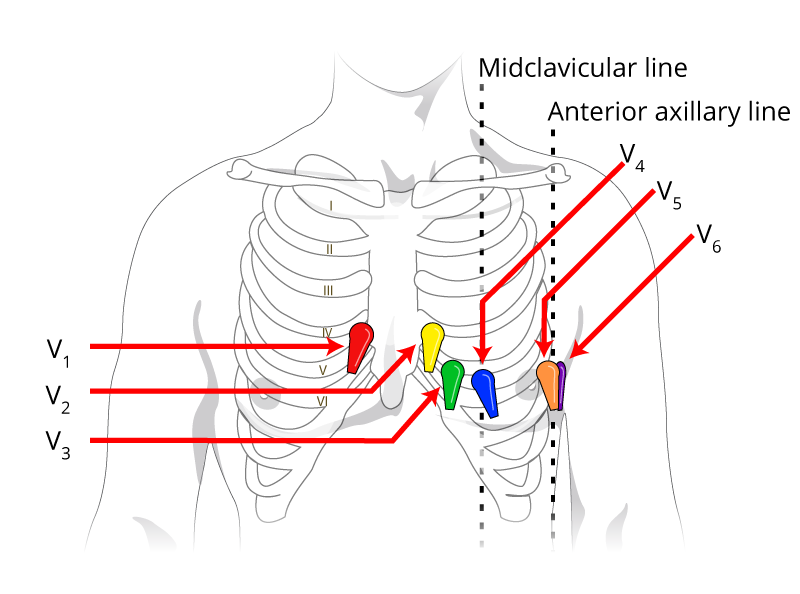 Settings for Sampling Panels in Lt - ECG and Heart Rate | ADInstruments