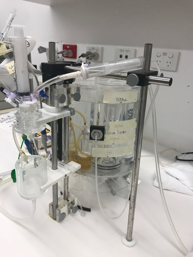 Understanding Diabetic hearts using Langendorff Perfusion and ...