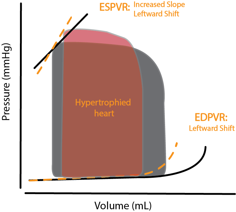 Cardiac Hypertrophy Research | Ventricular Pressure-Volume (PV ...