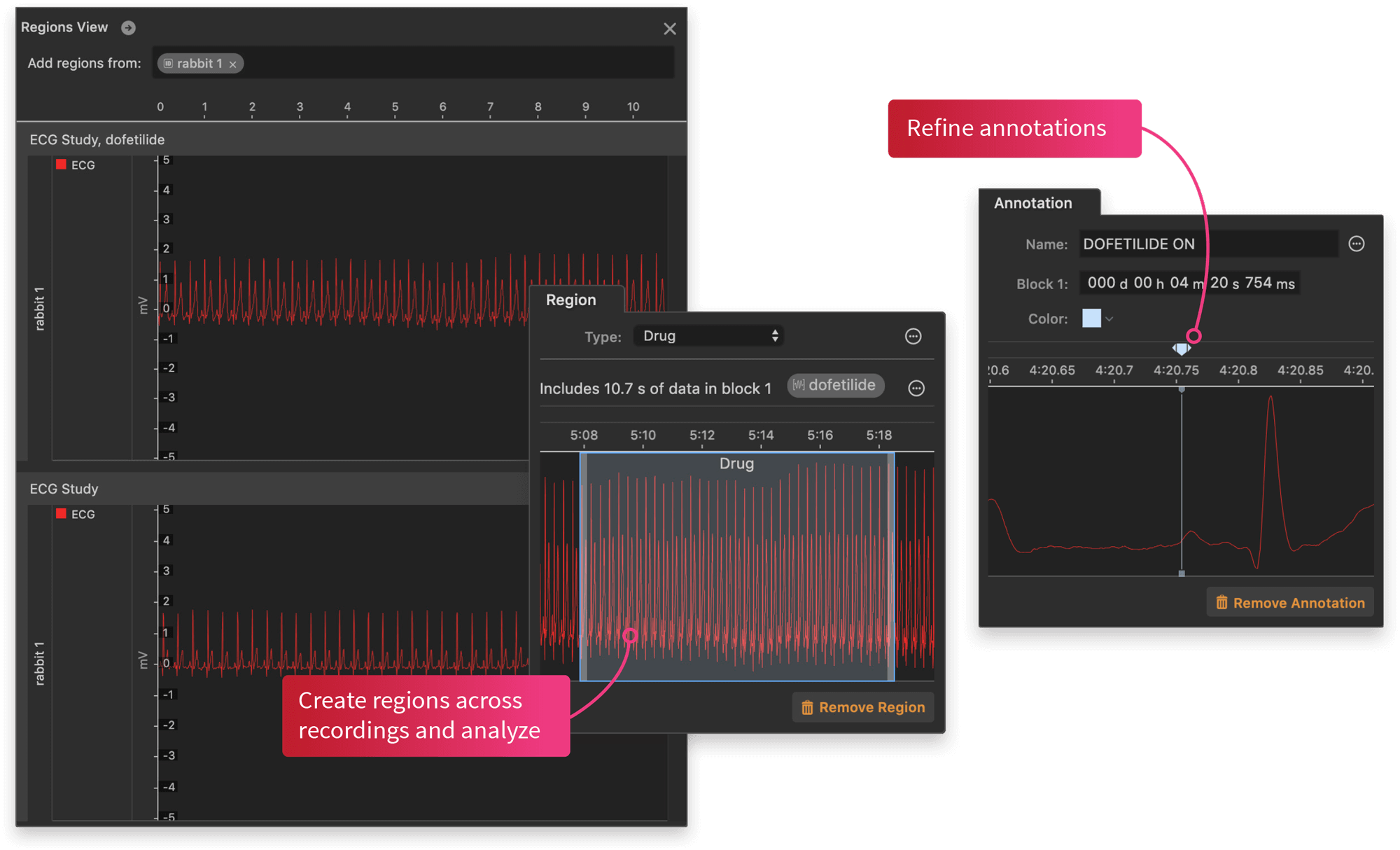 LabChart Lightning - ECG, ECG & EEG Data Acquisition (DAQ) Software ...