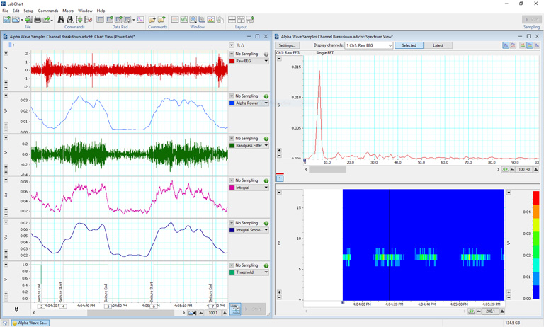 EEG | ADInstruments
