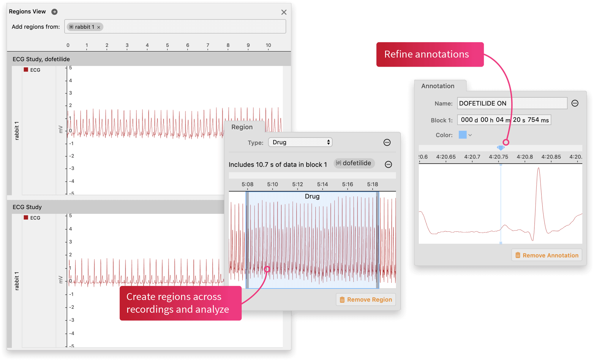 LabChart Lightning - ECG, ECG & EEG Data Acquisition (DAQ) Software ...