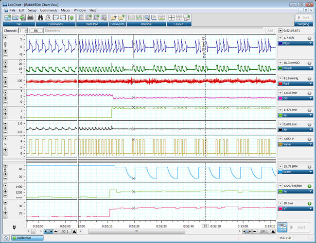 Using Synchrotron radiation CT imaging with LabChart to study regional ...