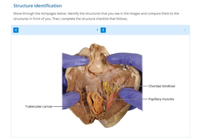 Heart Dissection | Lt Anatomy Collection | ADI
